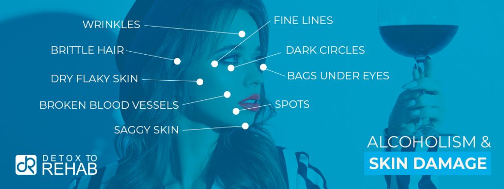 How Alcoholism Induces Skin Damage | Detox To Rehab